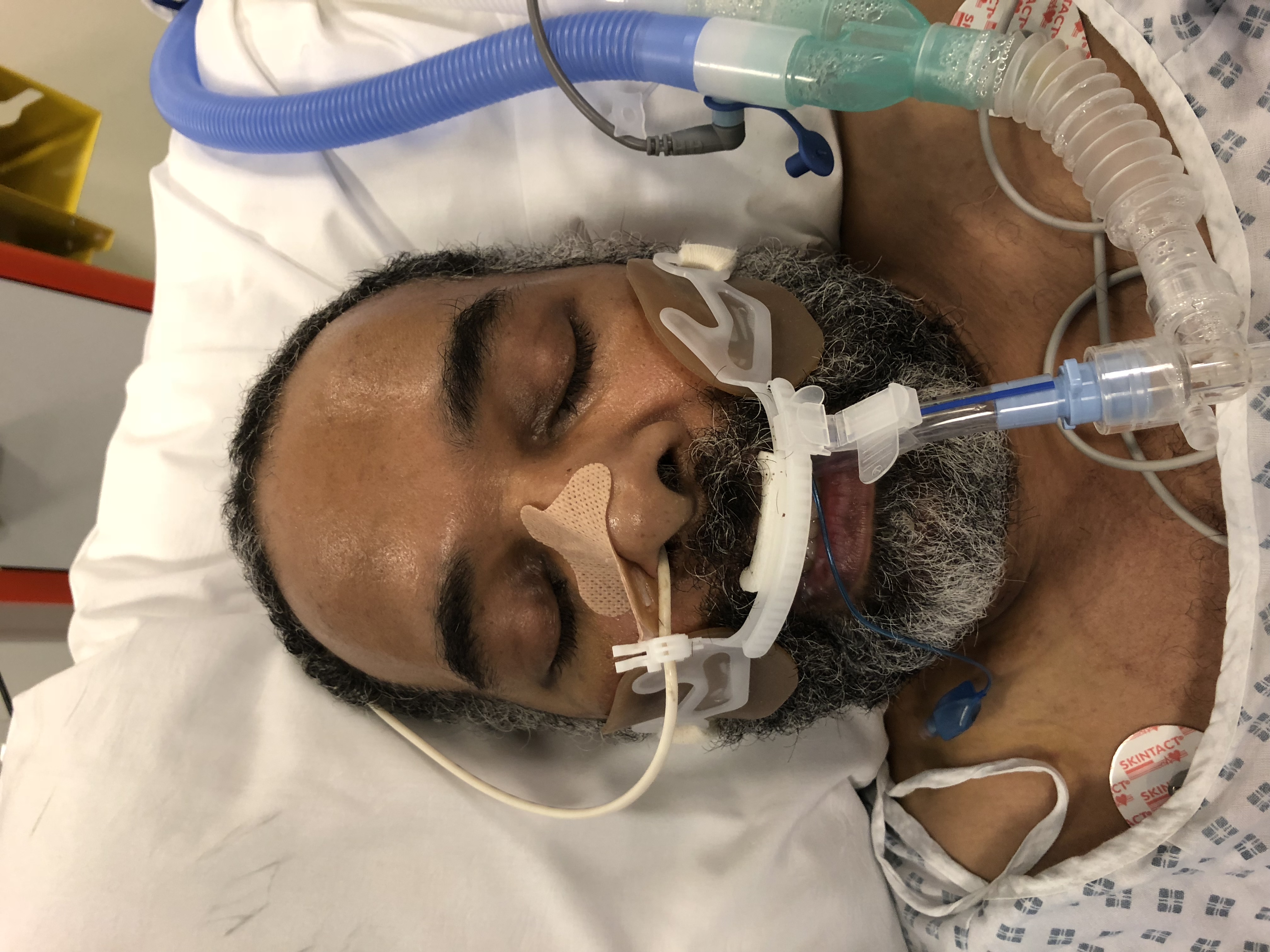 Mystery man in coma still unidentified three weeks after collapsing ...